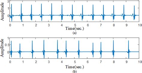 Figure 2 From An Automated Approach For Atrial Fibrillation Detection Using Electrocardiogram