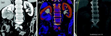 Ct Urography Radiology Key