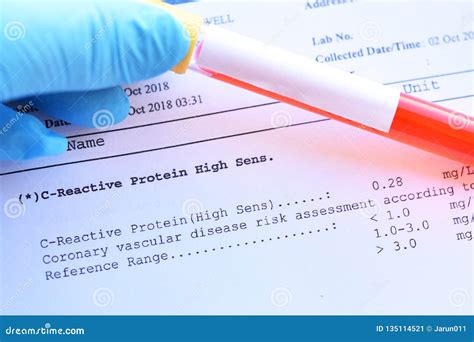 Normal Result Of C Reactive Protein Or Crp Test Stock Image Image Of Attack Medicine 135114521