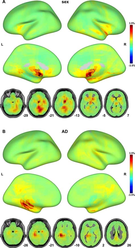 Occlusion Analysis Deep Learning At Brandi Hayes Blog
