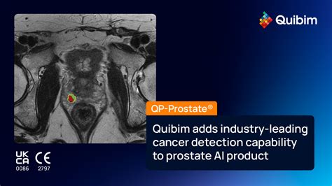 Quibim Adds Industry Leading Cancer Detection Capability To Prostate Ai