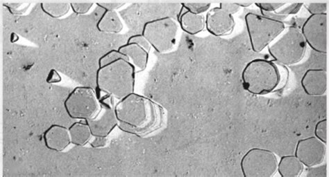 Radiology Exam 1 D2 Flashcards Quizlet