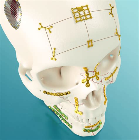 Oral And Maxillofacial Surgery Bionika