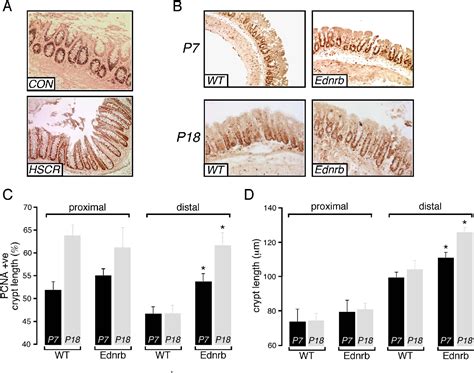 Figure 1 From Altered Goblet Cell Differentiation And Surface Mucus Properties In Hirschsprung