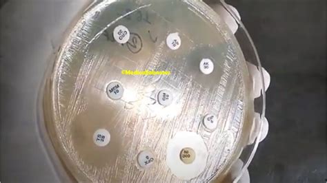 Ast Pattern Of Bacteria Introduction Group Of Ast Pattern List Of