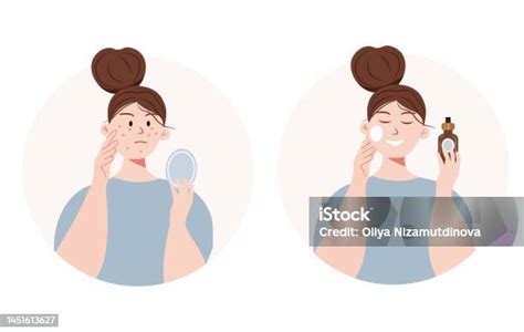 스킨케어 단계 여드름을 가진 소녀와 함께 Ðute 만화 삽화는 화장품 피부 문제를 사용합니다 십대 소녀에 대한 스톡 벡터 아트