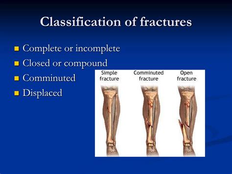Ppt Musculoskeletal Block Pathology Lecture 1 Fracture And Bone Healing Powerpoint
