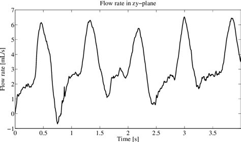 Figure 2 From In Vivo 3 D Vector Velocity Estimation With Continuous