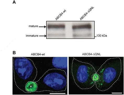 A Pdz Like Motif In The Biliary Transporter Abcb4 Interacts With The