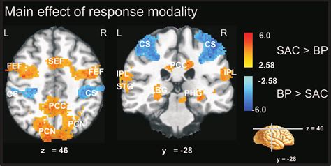 Brain Regions Showing A Main Effect Of Response Modality Areas Of