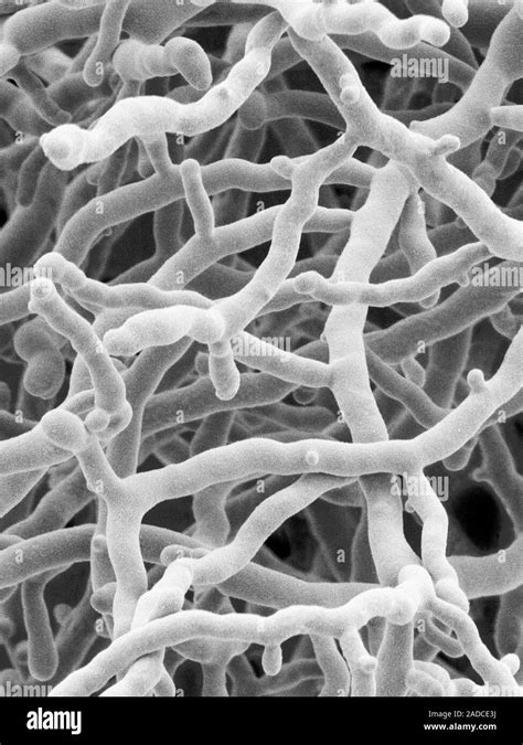 Scanning Electron Micrograph Sem Of Streptomyces Mashuensis Gram Positive Aerobic