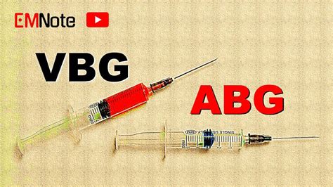 Vbg As A Replacement For Abg Youtu Be Rxzwtyueohu R Foamed911