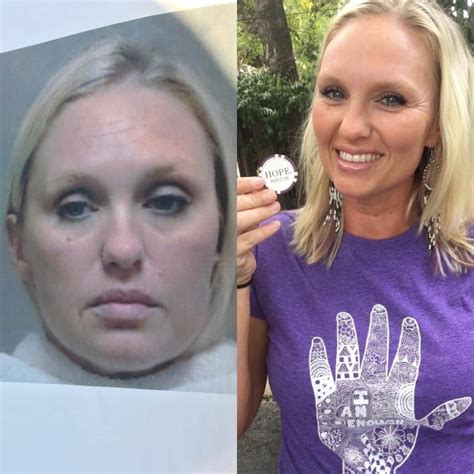 Pin On Before And After Drugs