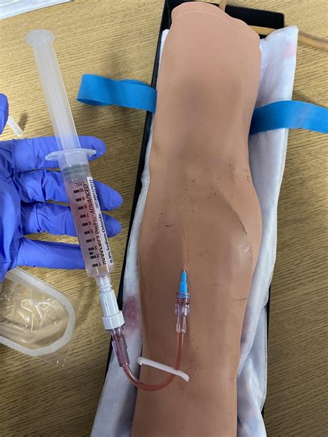 How To Initiate An Intravenous Catheter 7 Steps Instructables