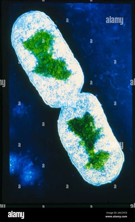 False Colour Transmission Electron Micrograph Of The Bacterium