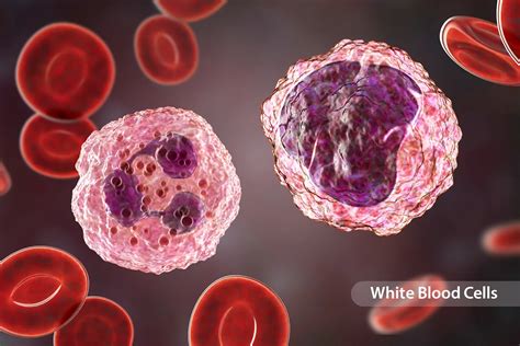Marginal Zone Lymphoma