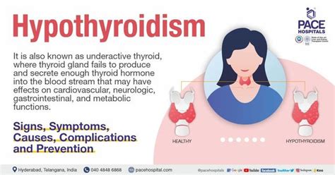Overactive Thyroid Hyperthyroidism Disease Symptoms And 48 Off
