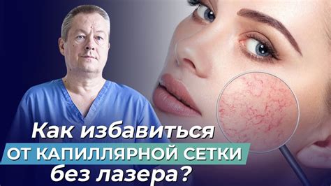 ЛУЧШИЙ МЕТОД избавиться ОТ СОСУДИСТЫХ ЗВЁЗДОЧЕК! Как вылечить ...
