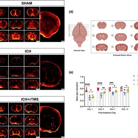 Design Of The Experiment A Rtms Treatment Was Started 3 Days After Download Scientific