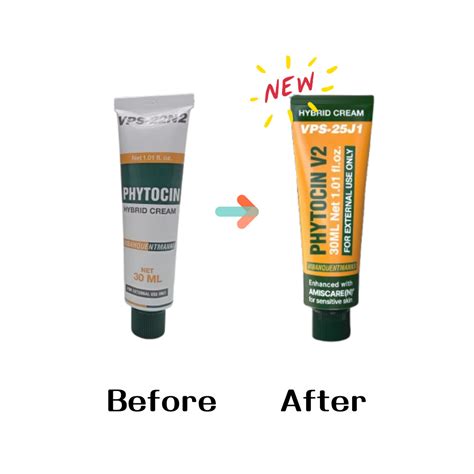Vqm Phytocin Hybrid Cream 30ml Shopee Singapore