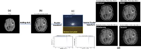 Assessing Lesion Segmentation Bias Of Neural Networks On Motion