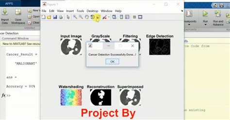 lung cancer detection using image processing matlab source code