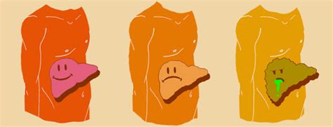 Hepatitis C Genotypes What To Know