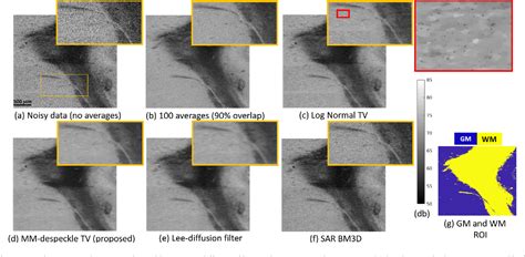 Figure 3 From A Novel Algorithm For Multiplicative Speckle Noise Reduction In Ex Vivo Human