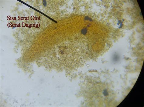 Rizqi Murtafi Ah Pemeriksaan Feses Lengkap