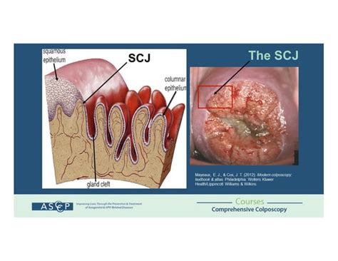 01 The Normal Cervix Pdf Pregnancy Reproductive Health