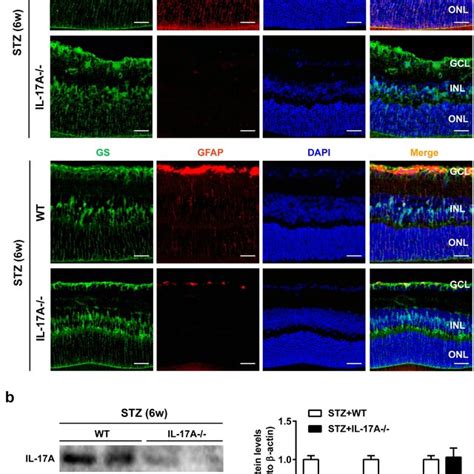 The Lack Of Il 17a Inhibits Diabetes Related Müller Cell Activation