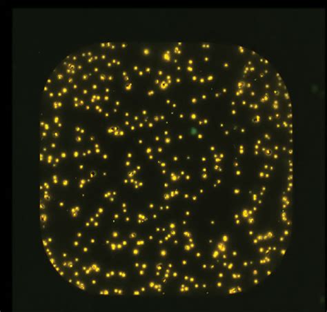 Protein Expression Strategies