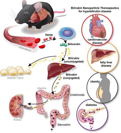 Elevated Bilirubin