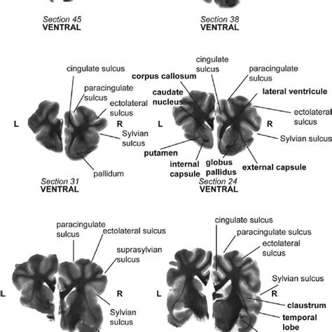 Cytoarchitecture Of The Paleocortex In The Pygmy Hippopotamus Piriform Download Scientific