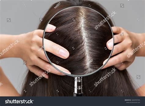 Scalp Health Images Stock Photos Vectors Shutterstock