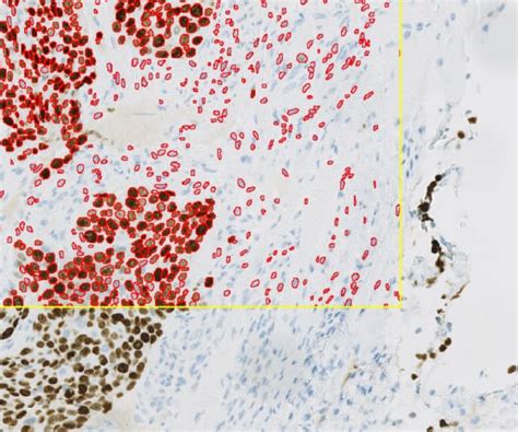 announcing instanseg a new nucleus and cell segmentation tool