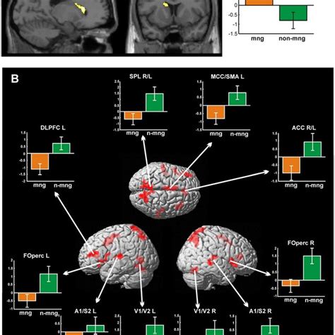 Significant Differential Effects Of Fmri Analysis Cluster Level