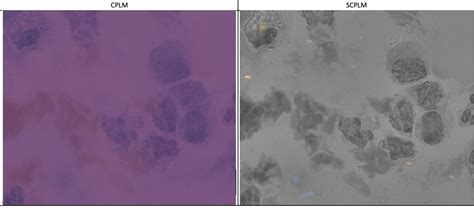 Validation Of Singe Shot Computational Polarized Microscopy For Crystal Analysis Of Synovial