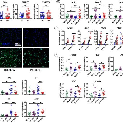 Lung Tissue From Idiopathic Pulmonary Fibrosis Ipf Patients And