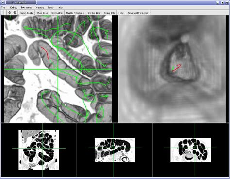 12 A Screenshot Of The Application During Sequential Path Extraction Download Scientific