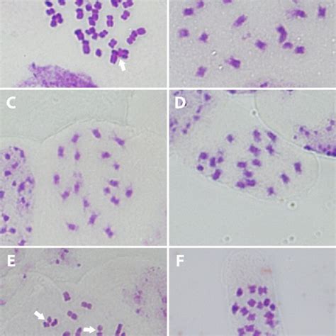 Root Tip Chromosome Squash Preparations For Members Of Costaceae Download Scientific Diagram