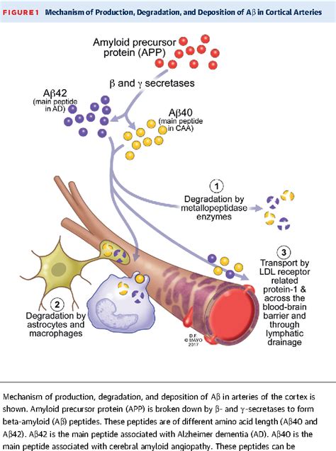 Figure 3 From Cerebral Amyloid Angiopathy Diagnosis Clinical