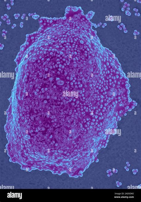 Coloured Scanning Electron Micrograph Sem Of Staphylococcus Aureus Colony Gram Positive Mrsa