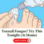 Baking Soda For Toenail Fungus Effective Home Remedy Tips