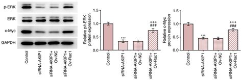 AKIP1 Regulates The Expression Of ERK C Myc Signaling Pathway In CcRCC