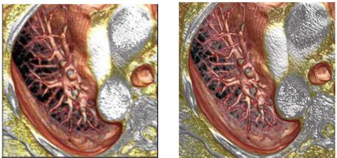 Comparison Of Shear Warp Left And Shear Image Order