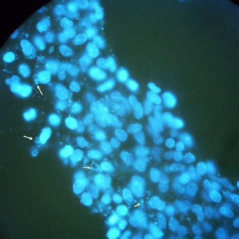 Fixed Cells On Cover Slips And Stained With Counterstain Dapi Arrow
