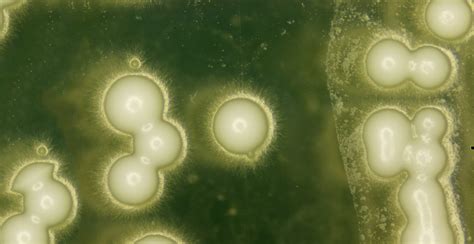 Onderzoek Bevestigt Gist Kan Cannabinoïden Namaken Mediwietsite