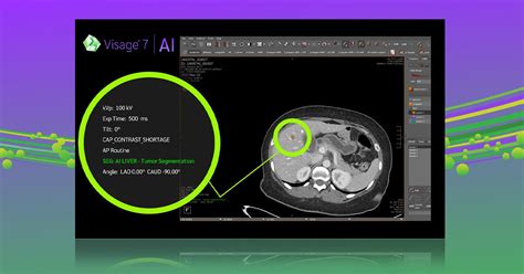 brad levin on linkedin algorithms have optimal workflow in practice if and only if the…