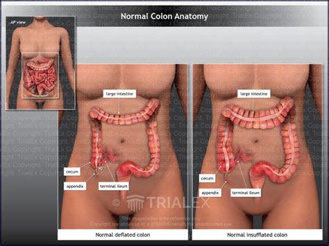Normal Colon Anatomy Anterior View Caucasian Female
